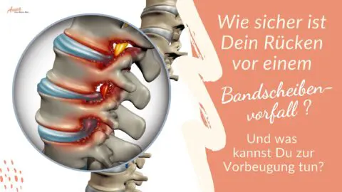 Stufenlagerung Rücken – bei akuten Rückenschmerzen